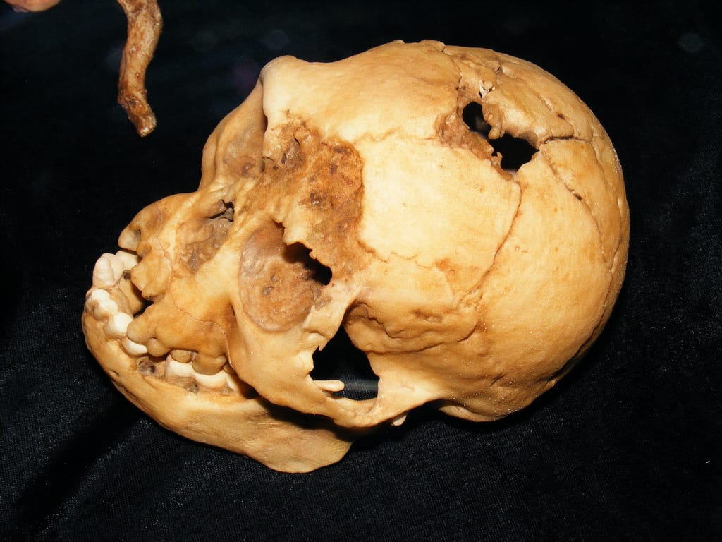 Homo floresiensis: What the “Hobbit” Reveals About Human Evolution ...